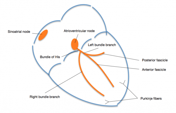 Bundle Branch Blocks: 101 - REBEL EM - Emergency Medicine Blog