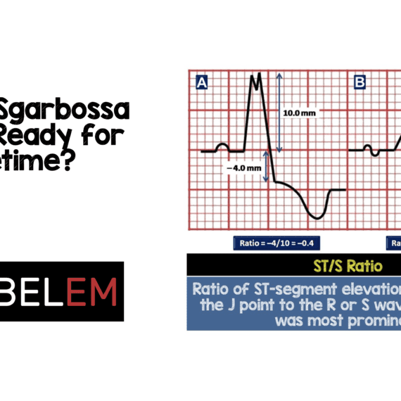 REBEL ECG of the Week #5