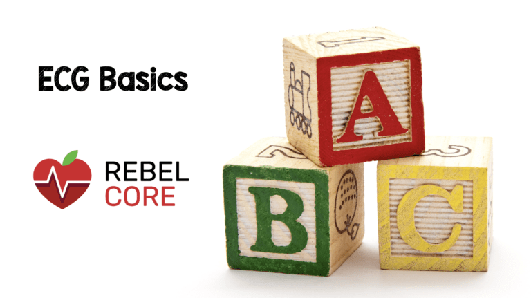 ECG Basics - REBEL EM - Emergency Medicine Blog