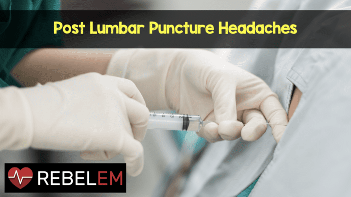 Post Lumbar Puncture Headaches - REBEL EM - Emergency Medicine Blog