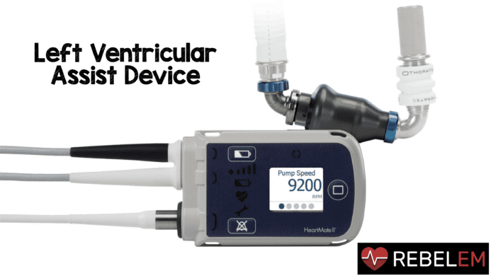 Left Ventricular Assist Device - REBEL EM - Emergency Medicine Blog