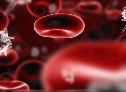 Episode 37 - Definitions and Identification of Sepsis: Sepsis 2.0 vs ...