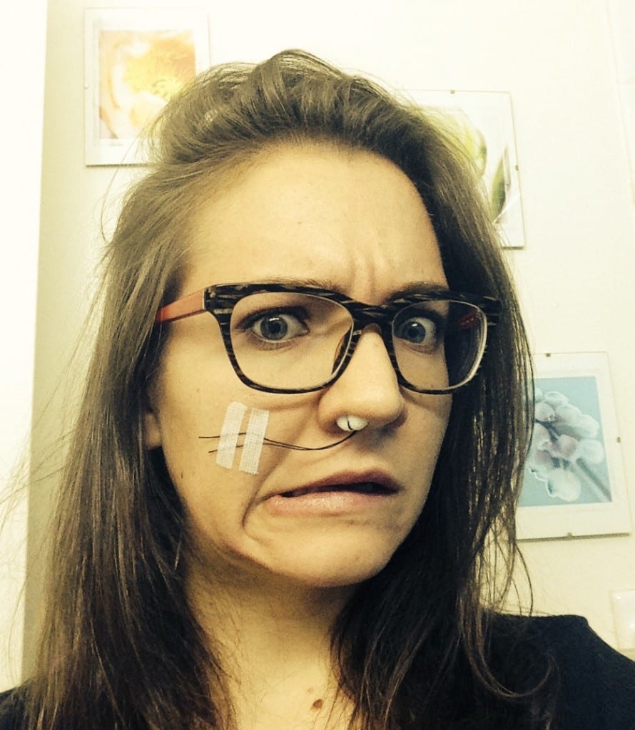 Do Patients with Epistaxis Managed by Nasal Packing Require ...