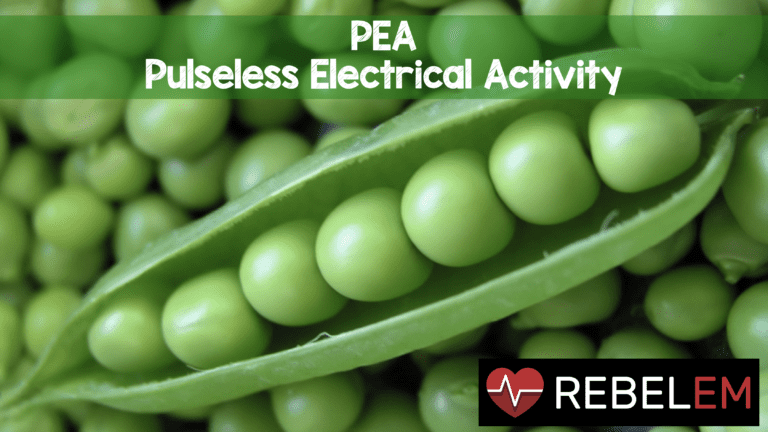 Beyond ACLS: A New Pulseless Electrical Activity Algorithm - REBEL EM ...