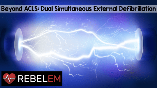 Beyond Acls Dual Simultaneous External Defibrillation Rebel Em Emergency Medicine Blog