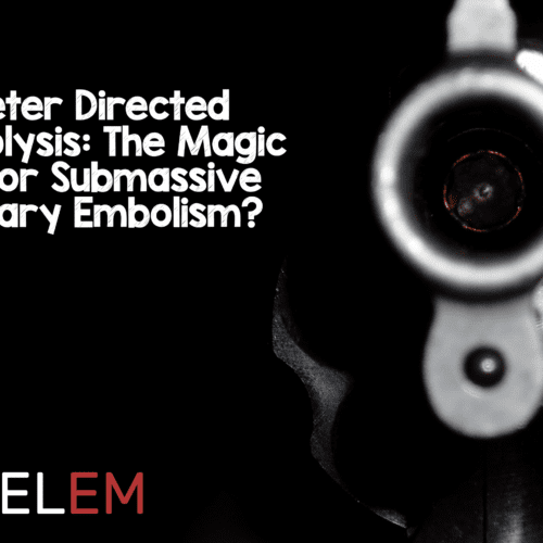 REBEL Cast Episode 30: The PESIT Trial – Do All Patients with 1st Time ...