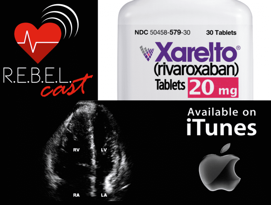 September 2015 REBELCast - REBEL EM - Emergency Medicine Blog