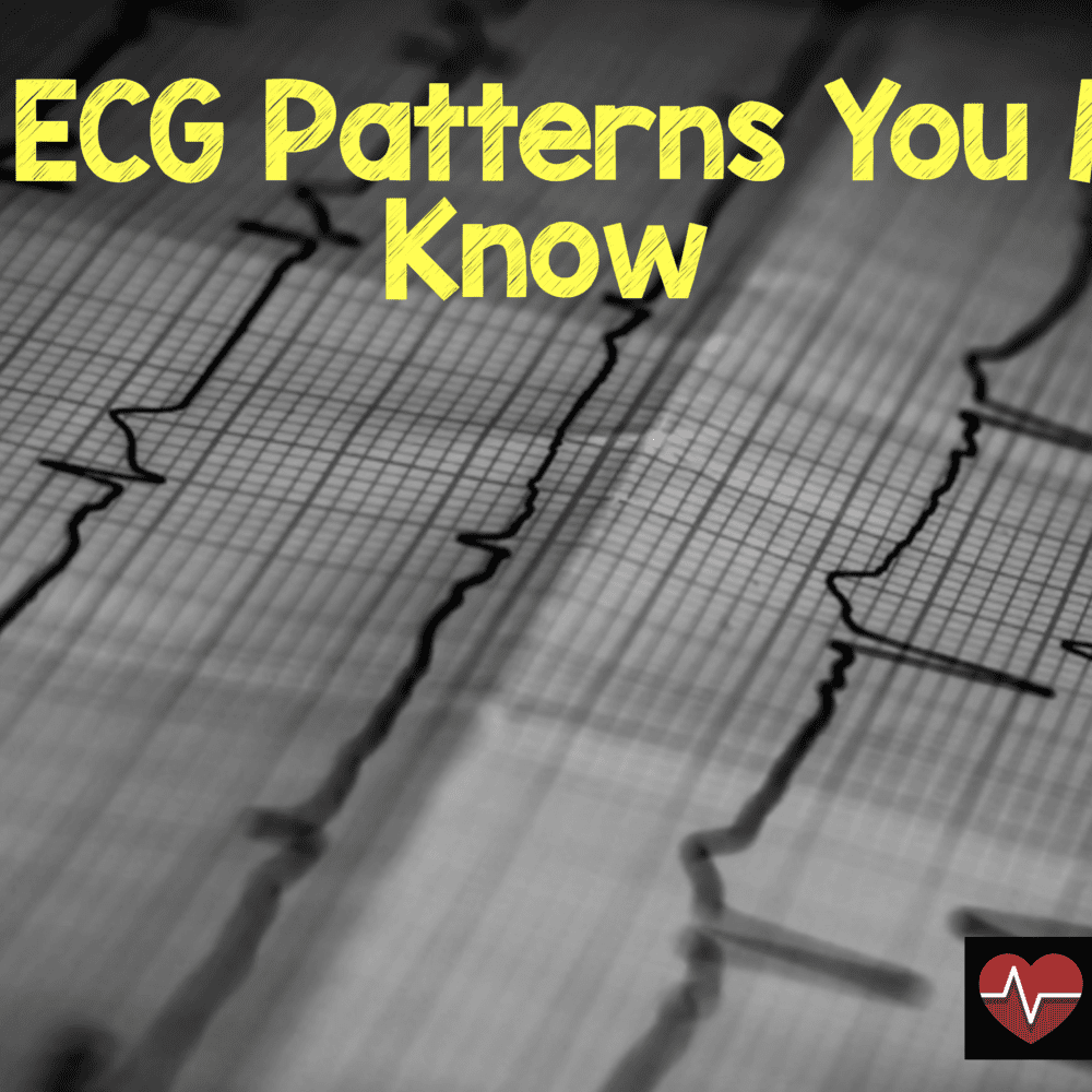Five ECG Patterns You Must Know | MED-TAC International Corp.
