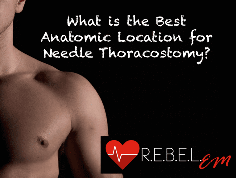 Needle Thoracostomy Title - REBEL EM - Emergency Medicine Blog
