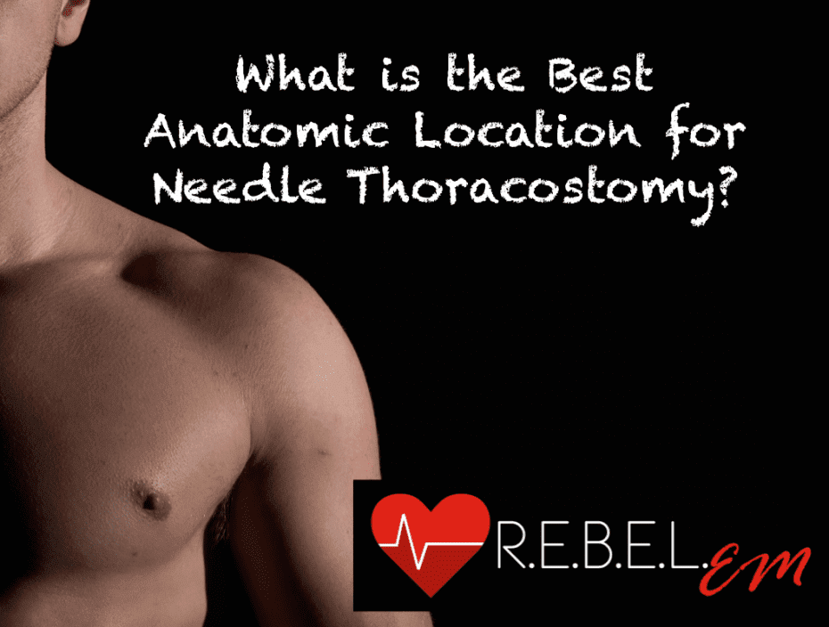Needle Thoracostomy Title - REBEL EM - Emergency Medicine Blog