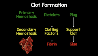 Clot Formation - REBEL EM - Emergency Medicine Blog