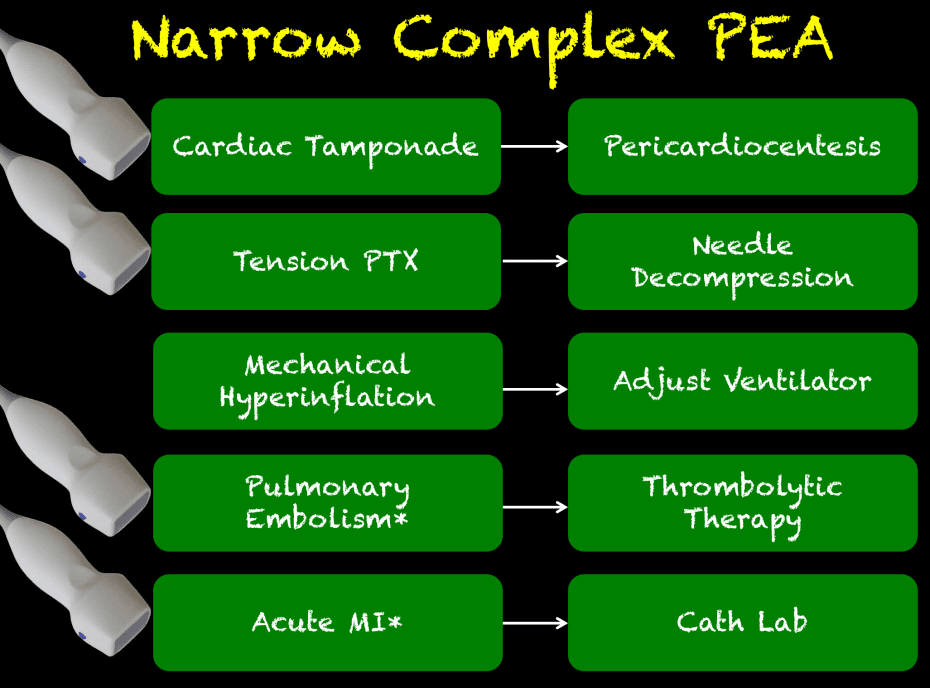 Narrow Complex PEA - REBEL EM - Emergency Medicine Blog