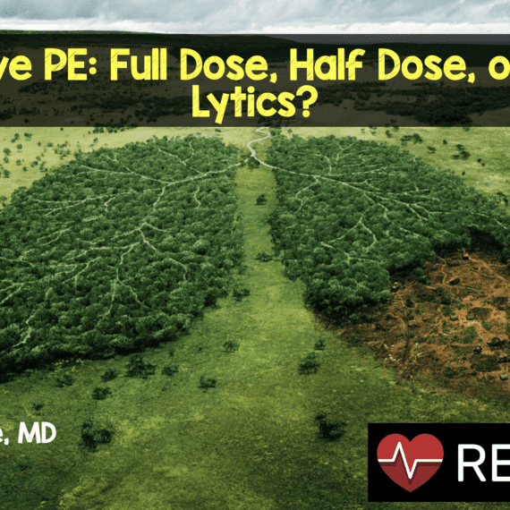 Treatment Of Submassive Pulmonary Embolism Pe Full Dose Half Dose
