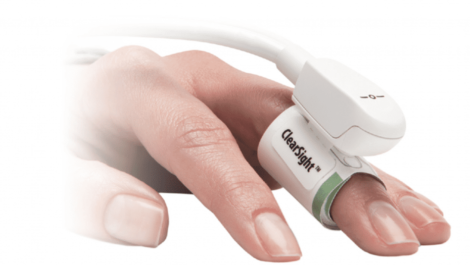 Is the Future of Non-Invasive Hemodynamic Monitoring Here and Ready for ...