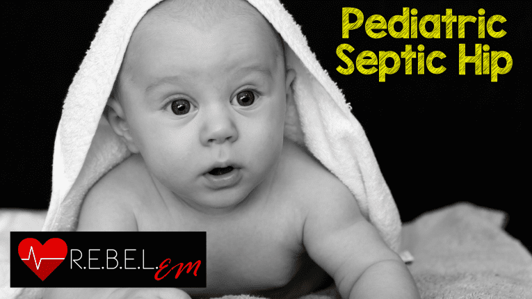 Pediatric Septic Hip - REBEL EM - Emergency Medicine Blog