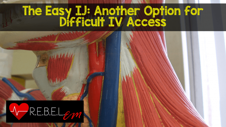 The Easy IJ: Another Option for Difficult IV Access in Stable Patients ...