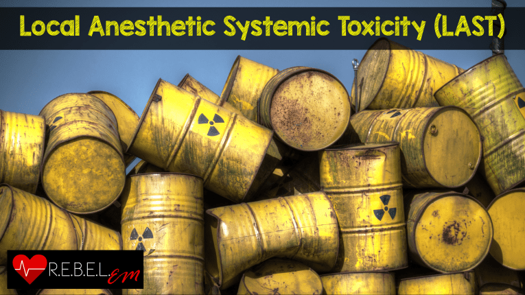 Local Anesthetic Systemic Toxicity (LAST) - REBEL EM - Emergency ...