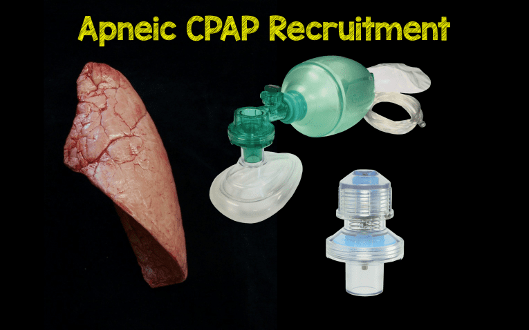 Apneic Oxygenation (ApOx): A Review of the Evidence in Critical Care ...