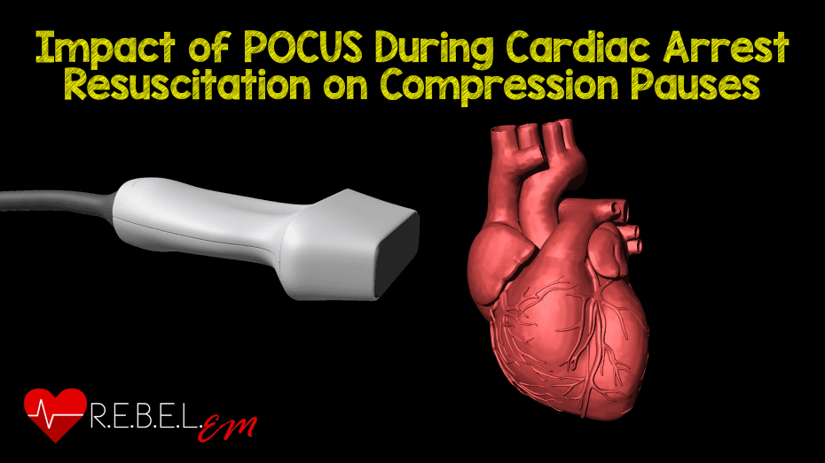 POCUS During Cardiac Arrest - REBEL EM - Emergency Medicine Blog