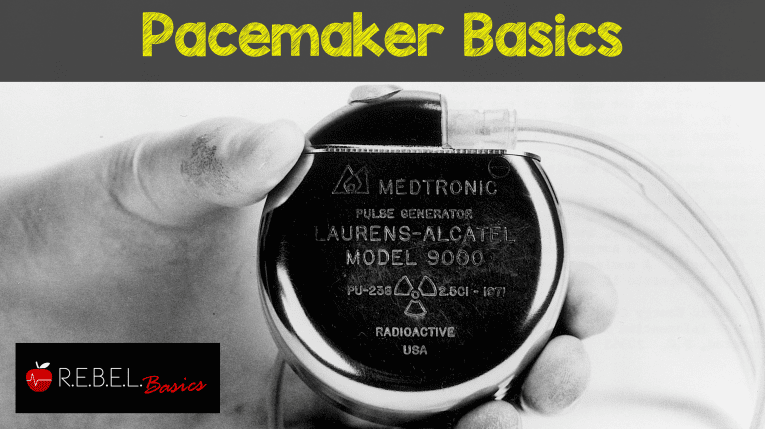 Pacemaker Basics - REBEL EM - Emergency Medicine Blog