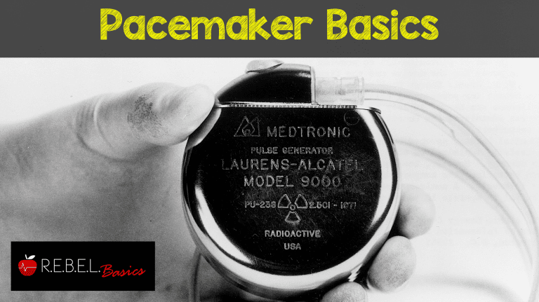 Pacemaker Basics - REBEL EM - Emergency Medicine Blog