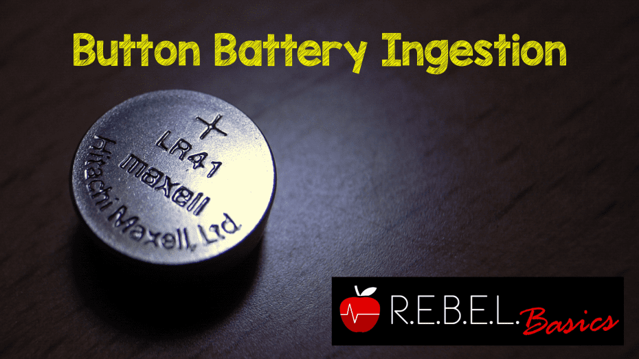 Button Battery Ingestion - REBEL EM - Emergency Medicine Blog