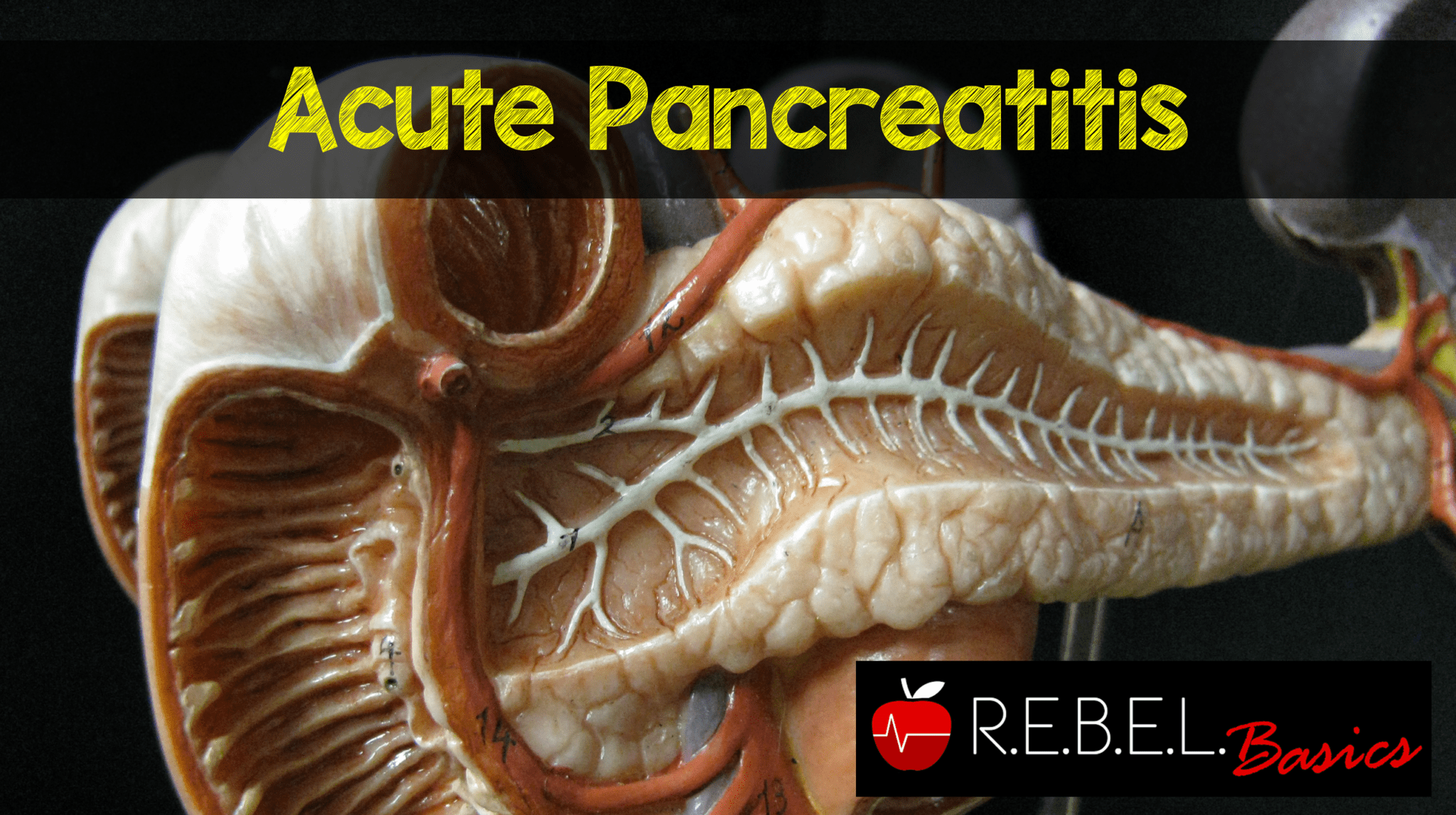 Acute Pancreatitis REBEL EM Emergency Medicine Blog