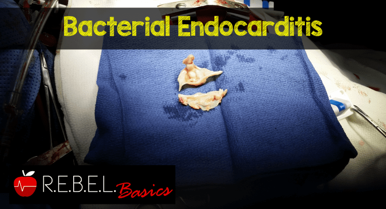 Bacterial Endocarditis - REBEL EM - Emergency Medicine Blog