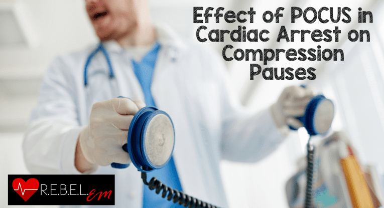 Effect of POCUS in Cardiac Arrest on Compression Pauses - REBEL EM ...