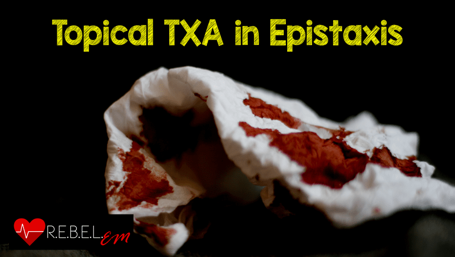 Topical TXA in Epistaxis - REBEL EM - Emergency Medicine Blog