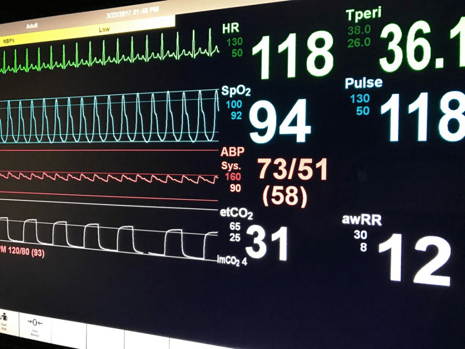 Unstable VS Monitor - REBEL EM - Emergency Medicine Blog