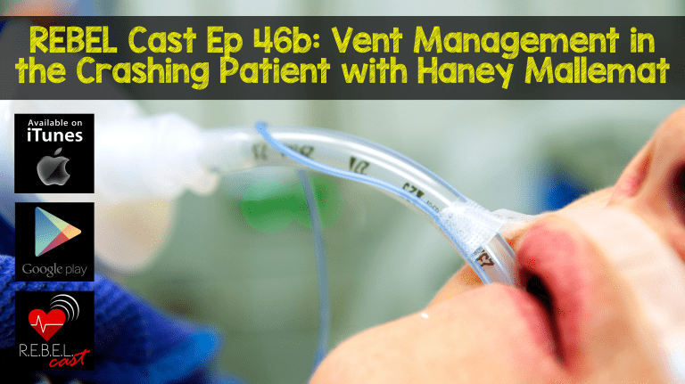 Vent Management - REBEL EM - Emergency Medicine Blog