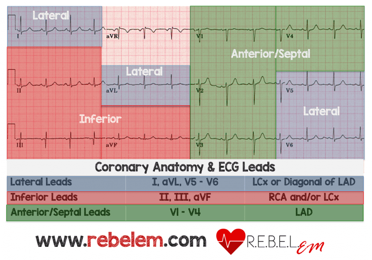 Chest Pain, "Negative" Stress Tests, POCUS, & ECG Equations - REBEL EM ...