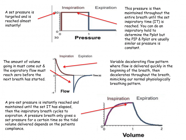 Normal Pressure Mode Waveforms - REBEL EM - Emergency Medicine Blog