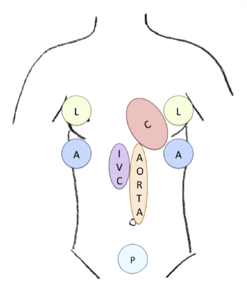 REBEL Cast Ep58 - Would you be SHoC-ED if POCUS did not Improve ...