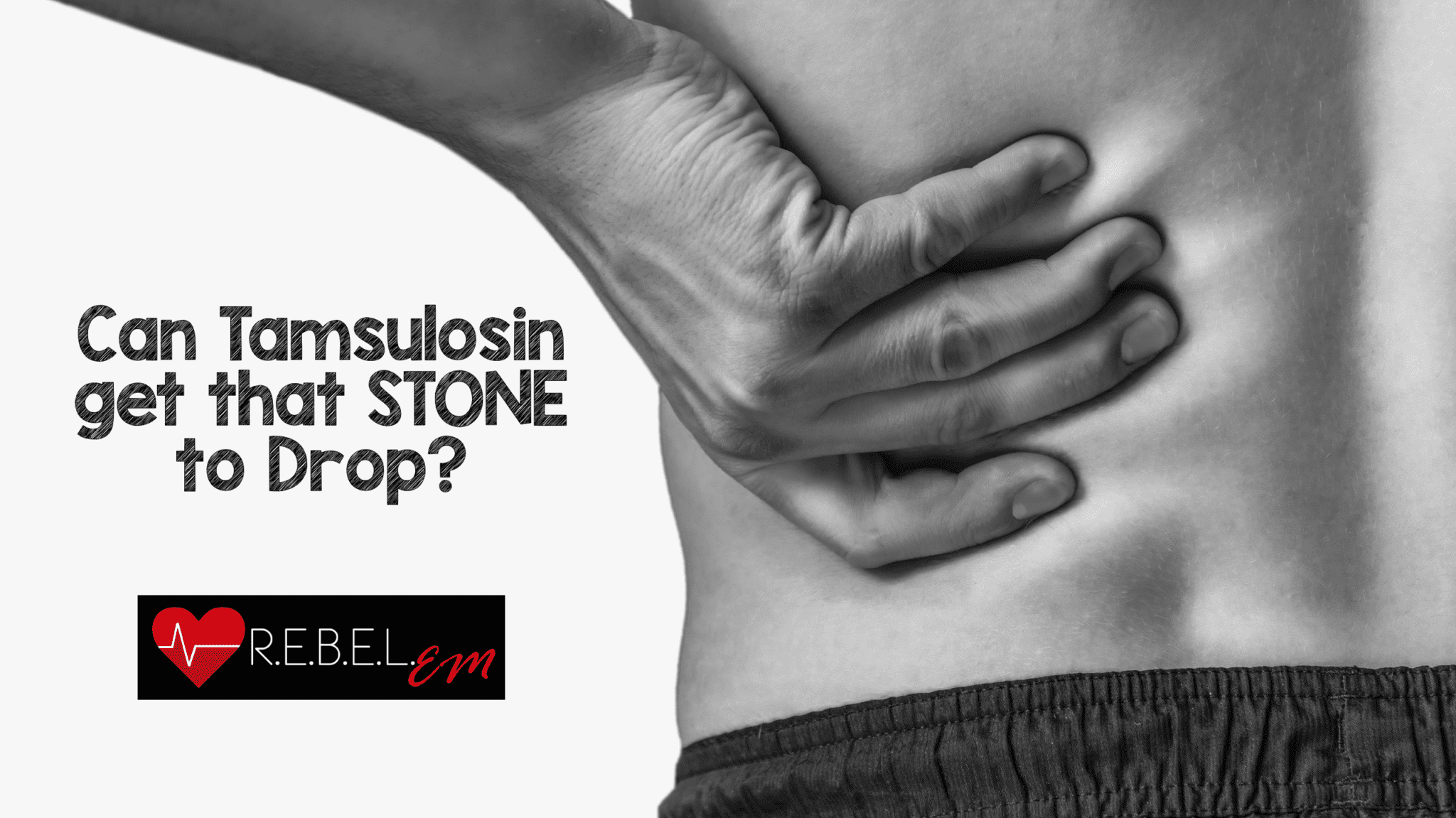 Can Tamsulosin Get That STONE To Drop REBEL EM Emergency Medicine Blog Can Tamsulosin Get That STONE To Drop REBEL EM Emergency Medicine Blog
