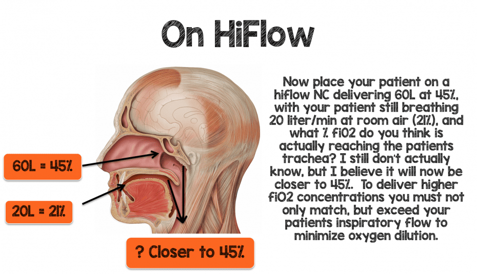 High Flow Nasal Cannula (HFNC) - Part 1: How It Works - REBEL EM ...
