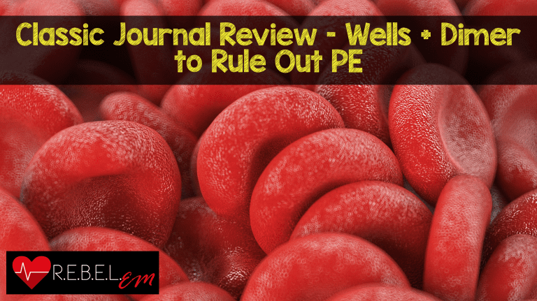 Classic Journal Review - Wells + Dimer to Rule Out PE - REBEL EM ...