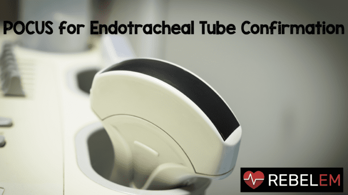 POCUS for Endotracheal Tube Confirmation - REBEL EM - Emergency ...