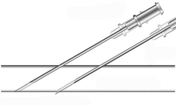 REBELCast Ep62 – US Guided PIVs with Jacob Avila, MD - REBEL EM ...