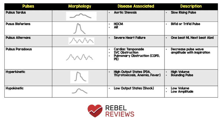 Arterial Pulses - REBEL EM - Emergency Medicine Blog