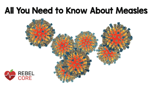 Measles - REBEL EM - Emergency Medicine Blog