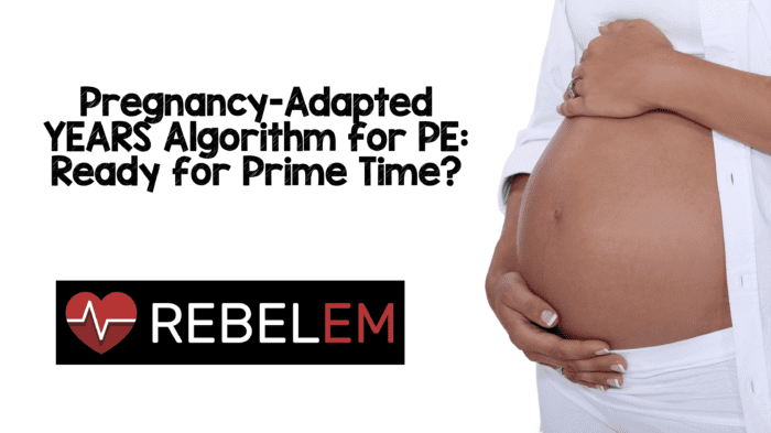 Pregnancy Adapted Years Algorithm For Pe Ready For Prime Time Rebel Em Emergency Medicine