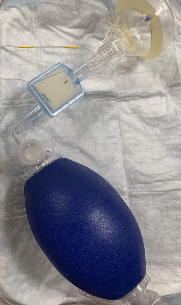 ETO2: The Future of RSI Preoxygenation in the ED? - REBEL EM ...