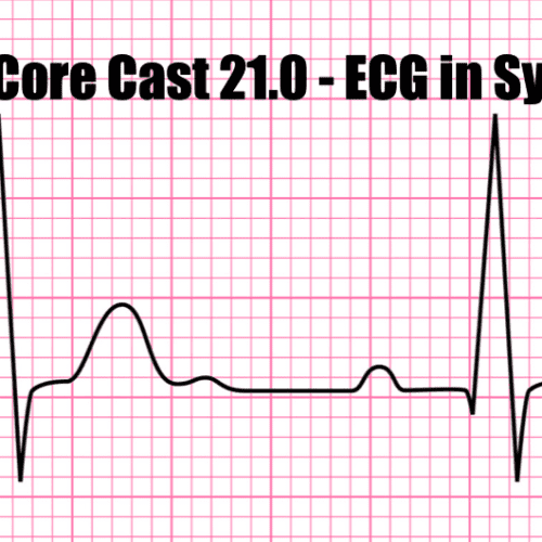 REBEL Core Cast 21.0 – ECG in Syncope Click here for Direct Download of ...
