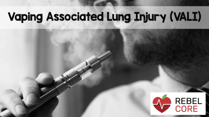 Vaping Associated Lung Injury (VALI) - REBEL EM - Emergency Medicine Blog Vaping Associated Lung Injury (VALI) - REBEL EM - Emergency Medicine Blog