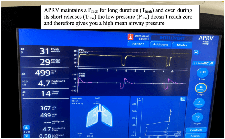 APRV Settings - REBEL EM - Emergency Medicine Blog