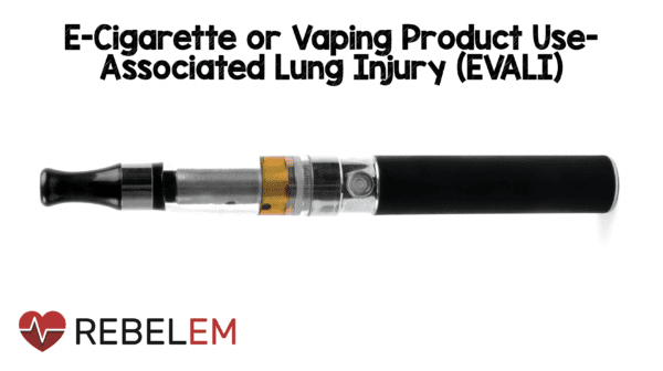 E-Cigarette or Vaping Product Use-Associated Lung Injury (EVALI ...