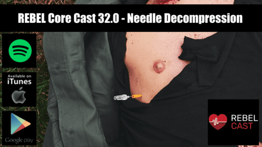 Podcast Image - REBEL EM - Emergency Medicine Blog