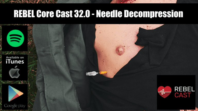 Podcast Image - REBEL EM - Emergency Medicine Blog